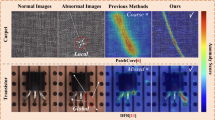 R3D-AD: Reconstruction via Diffusion for 3D Anomaly Detection | SpringerLink