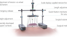 Use of a new vertical traction device for early traction-assisted ...
