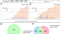 Claudin-18.2 and Trop-2 as Emerging Biomarkers in Biliary Tract Cancers ...