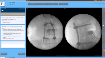 Assessing intraoperative pedicle screw placement accuracy using ...
