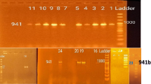 Unveiling the spectrum of vancomycin resistance in Staphylococcus ...