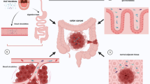 Intratumoral microbiome: a crucial regulating factor in development and ...