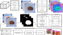 Skin lesion classification using adjacent dynamic and fixed ...