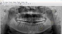 Evaluation of fractal analysis and radiomorphometric measurements of ...