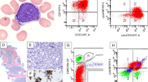 The Use of Targeted Therapy in Pediatric Acute Lymphoblastic Leukemia ...