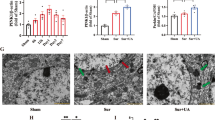 LncRNA-AC020978 Promotes Metabolic Reprogramming in M1 Microglial Cells ...