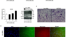 BMP10 positively regulates myogenic differentiation in C2C12 myoblasts ...