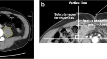 Circular stapled end colostomy versus conventional end colostomy ...