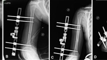 Radiological and Functional Outcomes of Joshi External Stabilization System (JESS) in Proximal ...