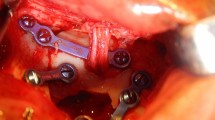 Intraoral Vestibular Approach for Reduction and Fixation of Isolated ...