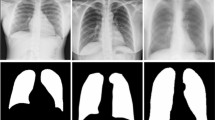 Lung Disease Classification with Deep Learning Enhanced CNN ...