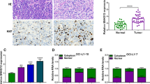 LILRB1 enhances the progression of diffuse large B-cell lymphoma ...