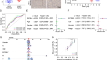 5′-tiRNA-Gln inhibits hepatocellular carcinoma progression by ...
