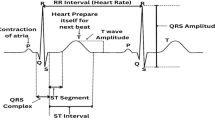 Noise Detection and Classification in Chagasic ECG Signals Based on One ...