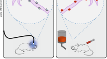 Optogenetic Animal Models of Depression: From Mice to Men | SpringerLink