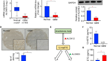 ALOX12 is required for p53-mediated tumour suppression through a ...