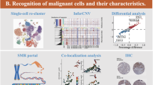 EPAS1 increases SDHA to inhibit proliferation of multiple myeloma cells ...