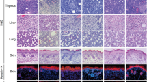 Activation of RIPK3 drives PANoptosis in human cells and inflammatory ...