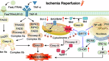 Regulated cell death pathways in cardiomyopathy | Acta Pharmacologica ...