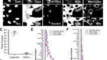 Cell Painting PLUS: expanding the multiplexing capacity of Cell Painting-based phenotypic ...