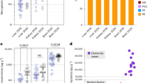 Identification and analysis of microplastics in peritumoral and tumor ...