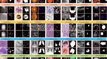nnU-Net: a self-configuring method for deep learning-based biomedical image segmentation ...