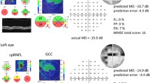 The impact of inferior visual field on frail status in glaucoma ...