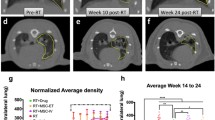 Radiation therapy-induced normal tissue damage: involvement of EMT ...