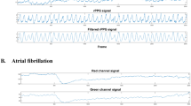 Cadmamba: a differential feature fusion-based neural network for coronary artery disease ...