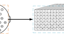 Motor imagery classification using sparse nonnegative matrix factorization and convolutional ...