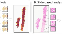 Combining graph neural network and Mamba to capture local and global tissue spatial ...