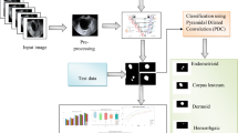 Segmentation of ovarian cyst using improved U-NET and hybrid deep ...