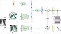 CheSS: Chest X-Ray Pre-trained Model via Self-supervised Contrastive ...