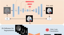 A unique unsupervised enhanced intuitionistic fuzzy C-means for MR brain tissue segmentation ...