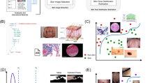 Beyond Fitzpatrick: automated artificial intelligence-based skin tone ...
