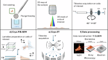 Visualizing the native cellular organization by coupling cryofixation ...