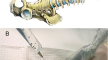 Comparative analysis of continuous pericapsular nerve group block and ...