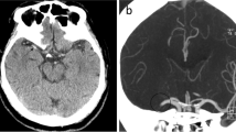 Right Middle Cerebral Artery M1 Segment Acute Occlusion with Tortuous ...