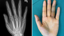 Localizing retrograde K-wire insertion points in distal phalanges using ...