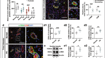 HIF-1α-mediated inhibition of the sFlt-1/sENG/TNF-α pathway promotes ...