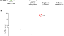 Valosin containing protein (VCP): initiator, modifier, and potential ...