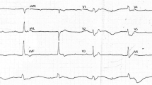 Insights Into the Emerging Role of Myocarditis in Dengue Fever ...