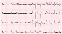 Distinct Challenges of Eruptive and Non-Eruptive Calcified Nodules in ...