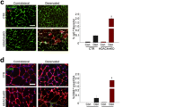 HDAC11 deficiency regulates age-related muscle decline and sarcopenia ...