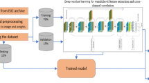 Skin lesion classification using adjacent dynamic and fixed ...