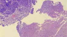 Articles | Clinical Research in Cardiology | Springer Nature Link