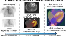 Topical Collection on Nuclear Cardiology | Springer Nature Link