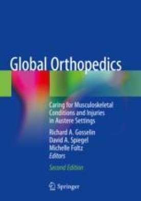 Anesthesia for Orthopedic Surgery in Austere Environments | SpringerLink