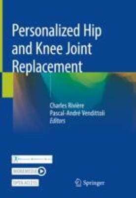 The Kinematic Alignment Technique for Total Knee Arthroplasty ...