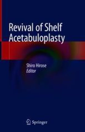 Shelf Acetabuloplasty in Comparison with Curved Periacetabular ...